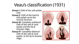Management of Cleft Lip and Palate - Orthodontics | PPTX