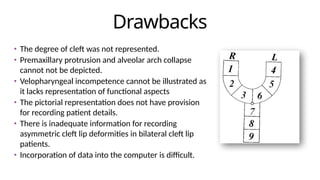 Management of Cleft Lip and Palate - Orthodontics | PPTX