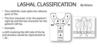Management of Cleft Lip and Palate - Orthodontics | PPTX