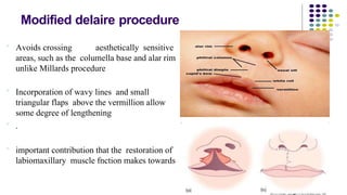 Mitmidsr-cleft-lip-and-palate-final.pptx