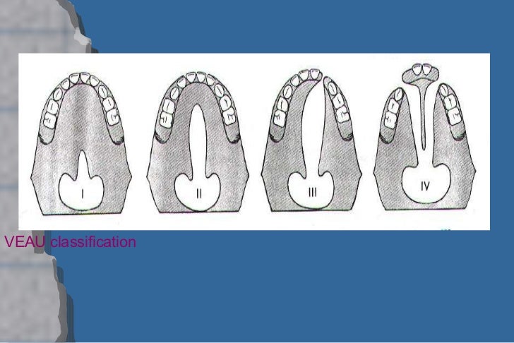 Surgery 5th year, 3rd lecture/part one (Dr. Ari Raheem Qader)