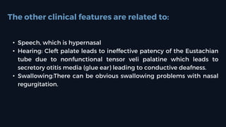Cleft%20lip%20and%20Palate.pptx