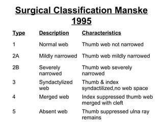 Cleft hand | PPT