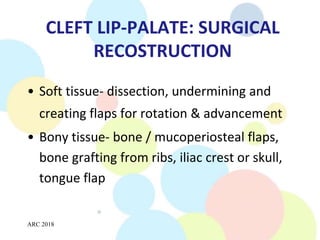 Cleft L-P (2).pptx