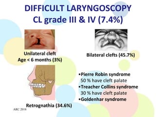 Cleft L-P (2).pptx