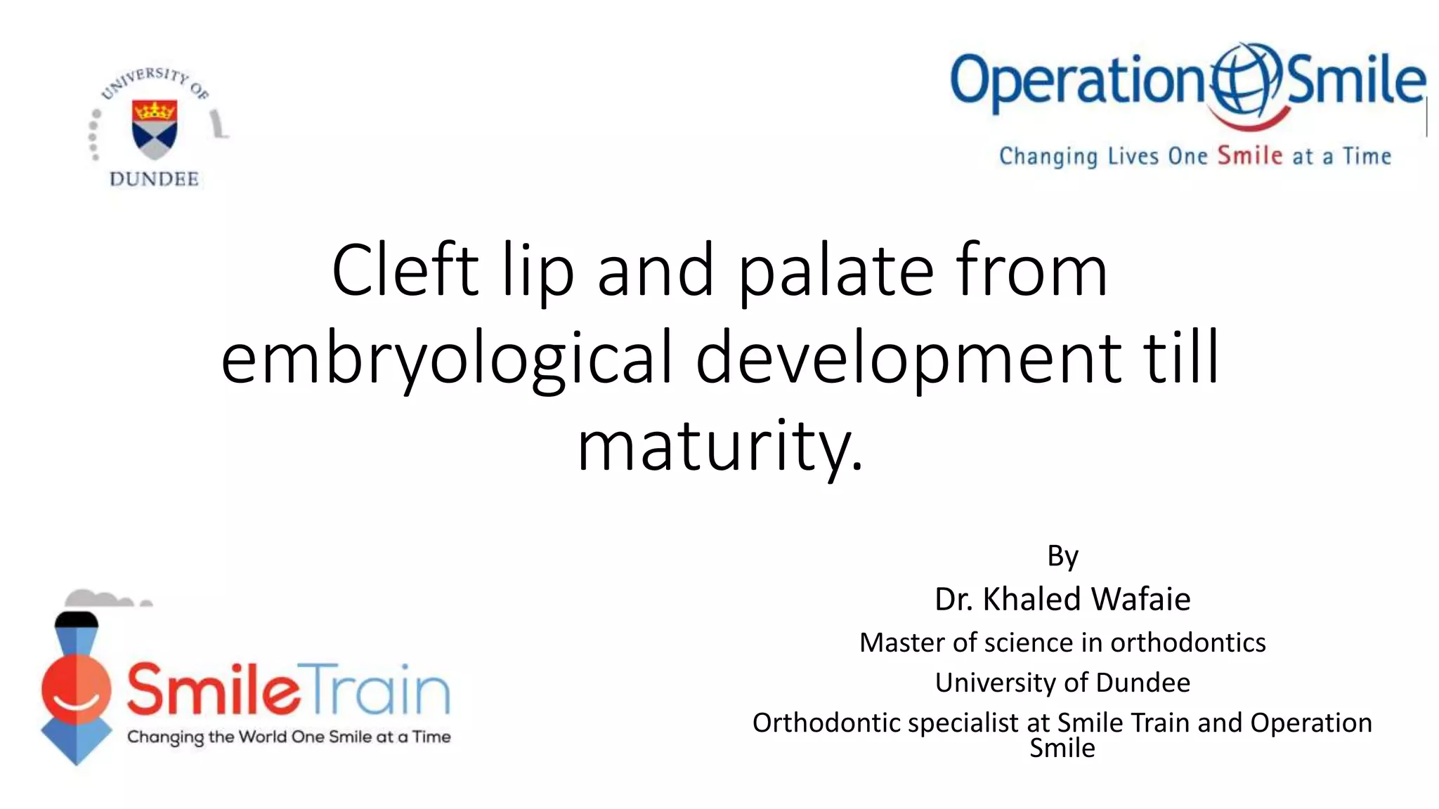 Cleft lip and palate from embryological development till maturity. | PPTX