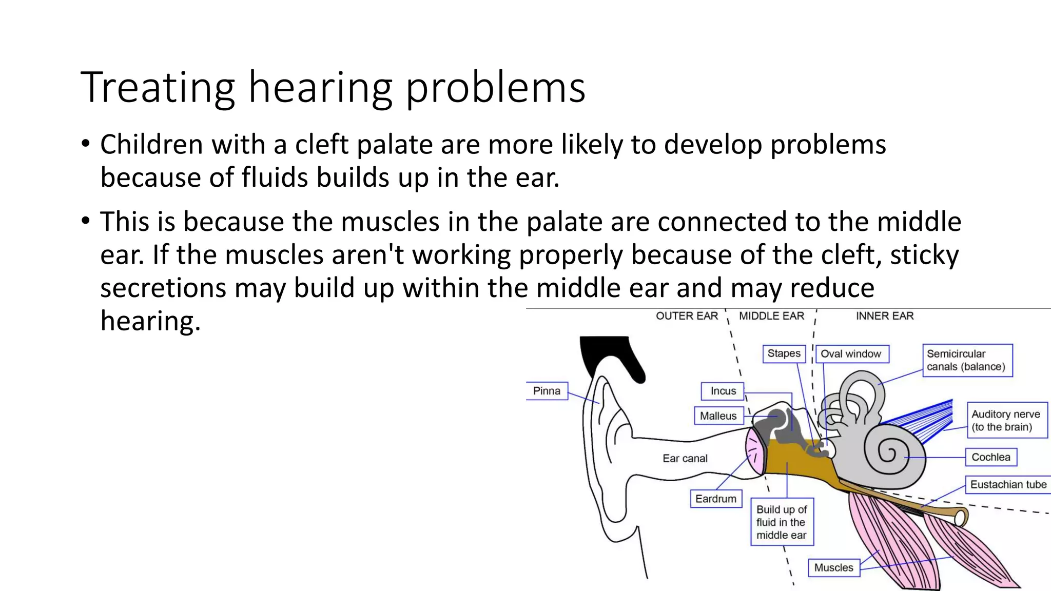 Cleft lip and palate from embryological development till maturity. | PPTX