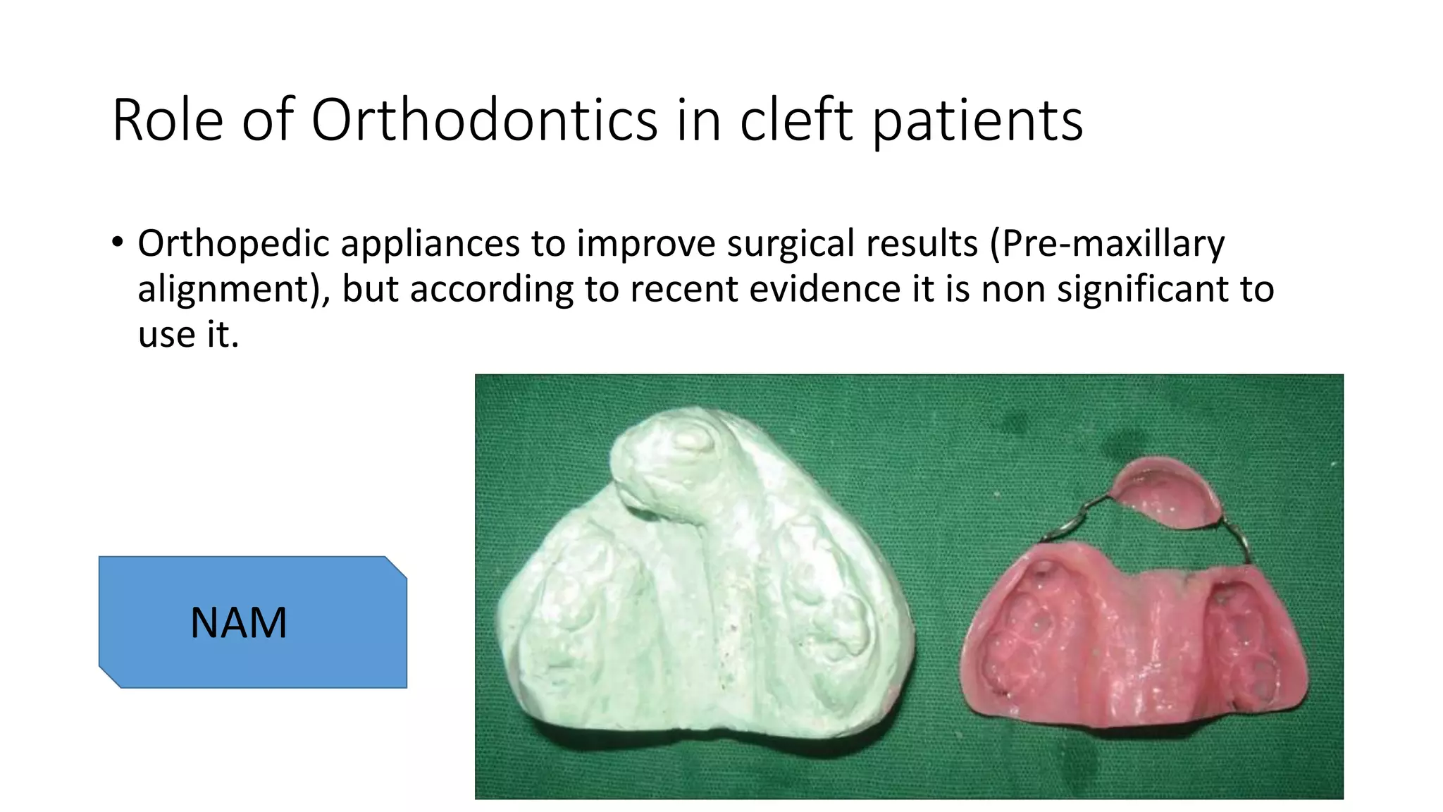 Cleft lip and palate from embryological development till maturity. | PPTX