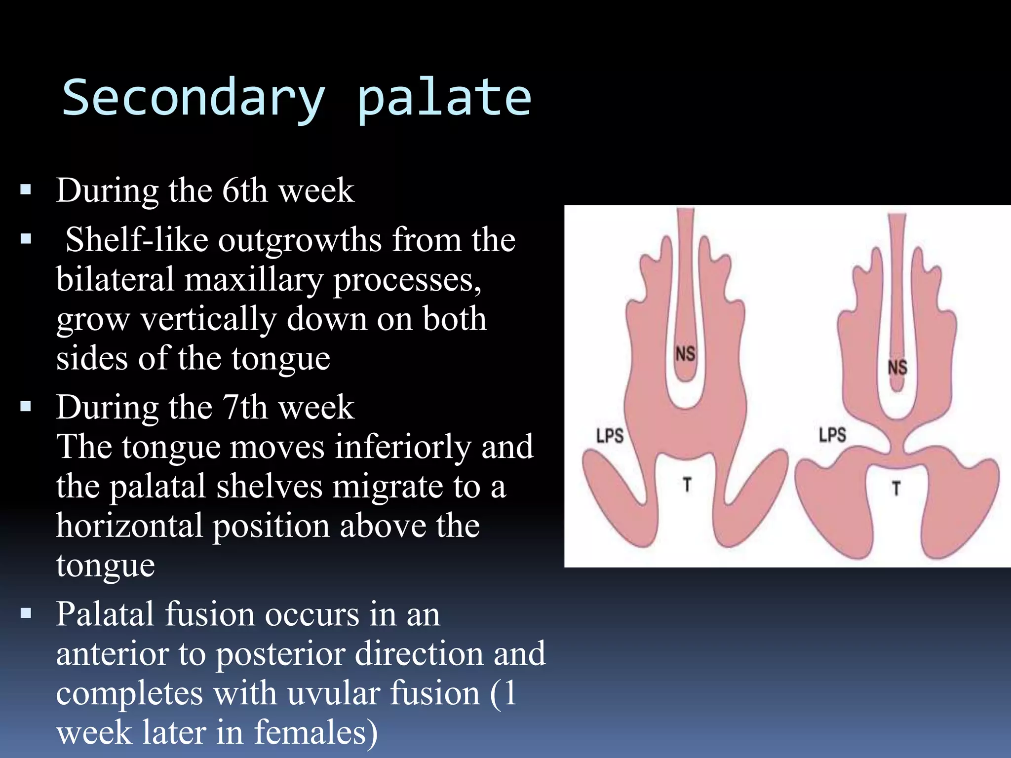 Cleft lip and Cleft palate embryology, features, and management | PPTX
