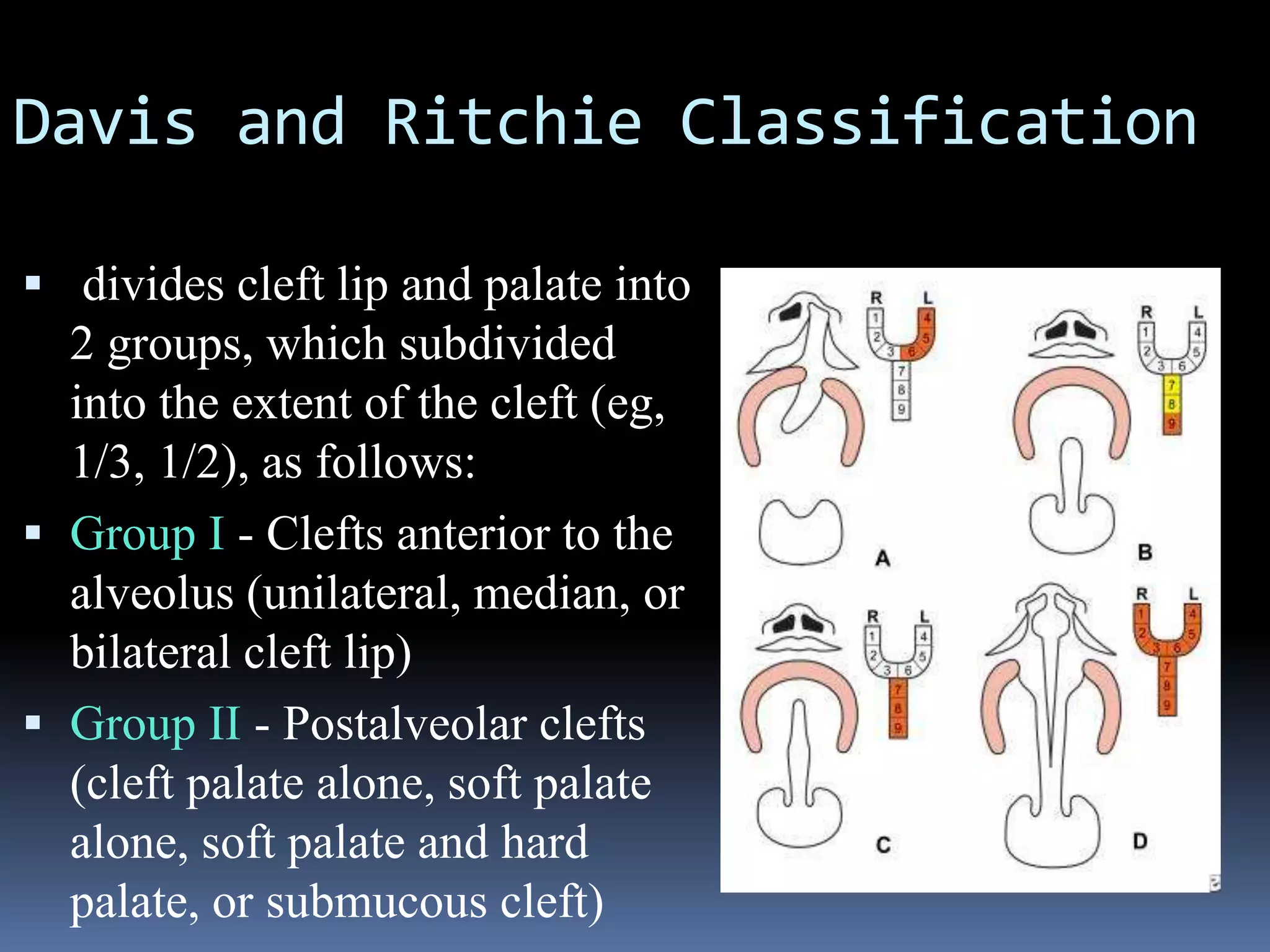 Cleft lip and Cleft palate embryology, features, and management | PPTX