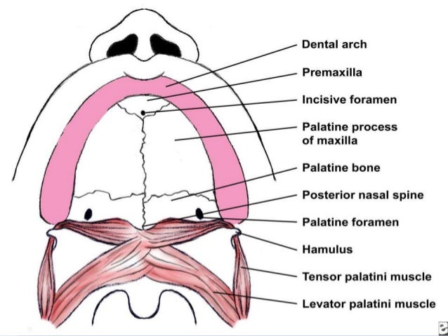 Cleft lip and Cleft palate embryology, features, and management