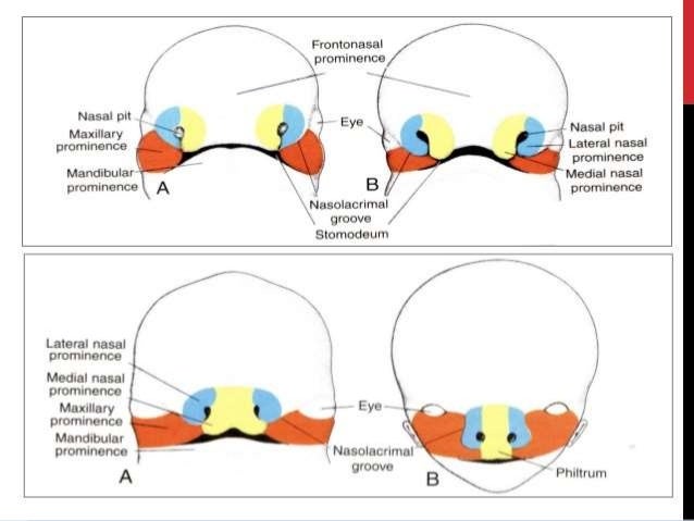Cleft lip and Cleft palate embryology, features, and management