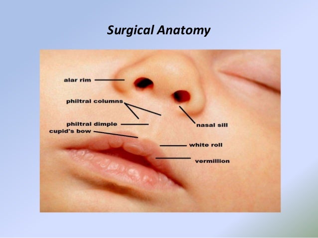 Clinical aspects of cleft lip repair