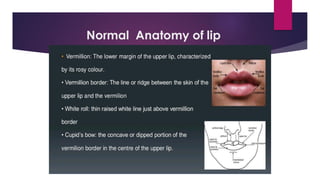 cleft lip.pdf