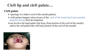 cleft lip.pptx | Pregnancy | Reproductive Health