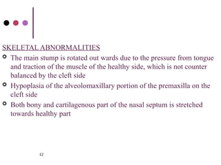 cleft lip and palate and its management.pptx