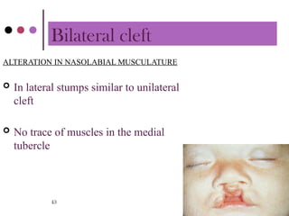 cleft lip and palate and its management.pptx