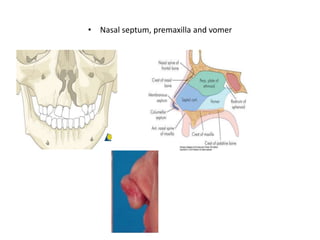 Cleft lip bilateral | PPTX