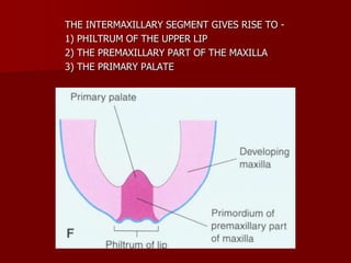 Cleft Lip & Palate | PPT