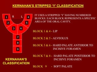 Cleft Lip & Palate | PPT