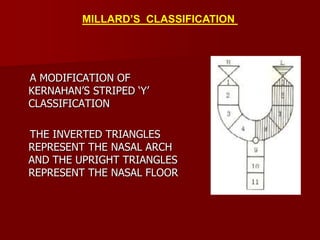 Cleft Lip & Palate | PPT