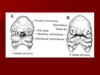 Cleft Lip & Palate | PPT