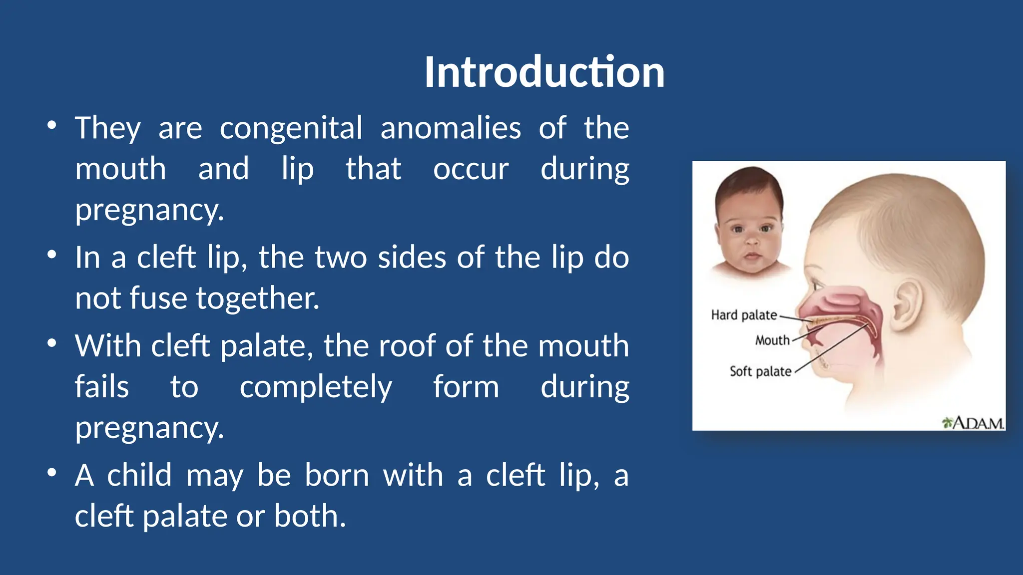 Cleft Lip and Cleft Palate - an Overview and Management | PPTX