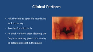 Cleft Lip and Cleft Palate - an Overview and Management | PPTX