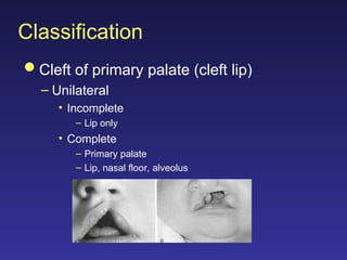 Cleft Lip-Primary & Secondary Deformities.ppt