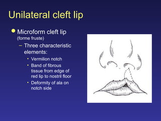 Cleft Lip-Primary & Secondary Deformities.ppt