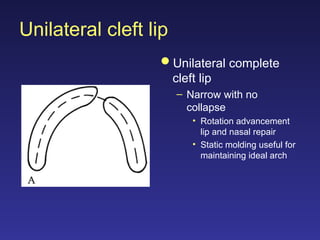 Cleft Lip-Primary & Secondary Deformities.ppt