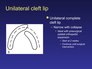 Cleft Lip-Primary & Secondary Deformities.ppt