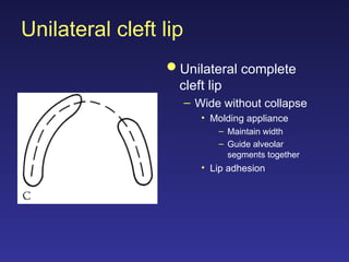Cleft Lip-Primary & Secondary Deformities.ppt