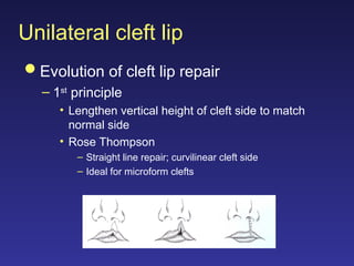 Cleft Lip-Primary & Secondary Deformities.ppt
