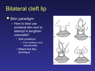 Cleft Lip-Primary & Secondary Deformities.ppt