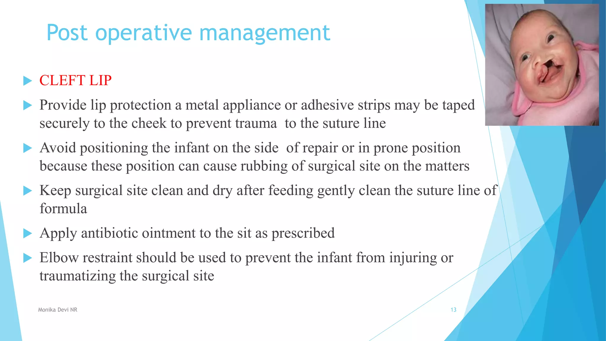 CLIFT LIP AND CLEFT PALATE | PPTX | Ear, Nose and Throat Conditions | Diseases and Conditions