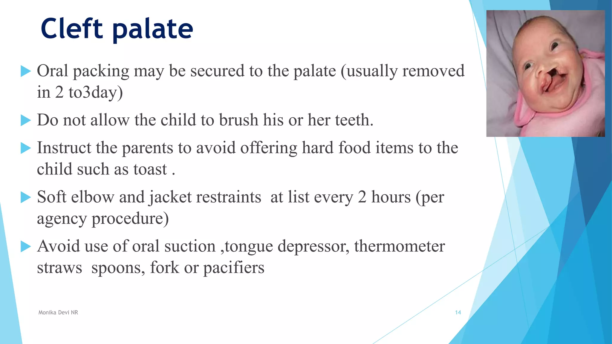 CLIFT LIP AND CLEFT PALATE | PPTX