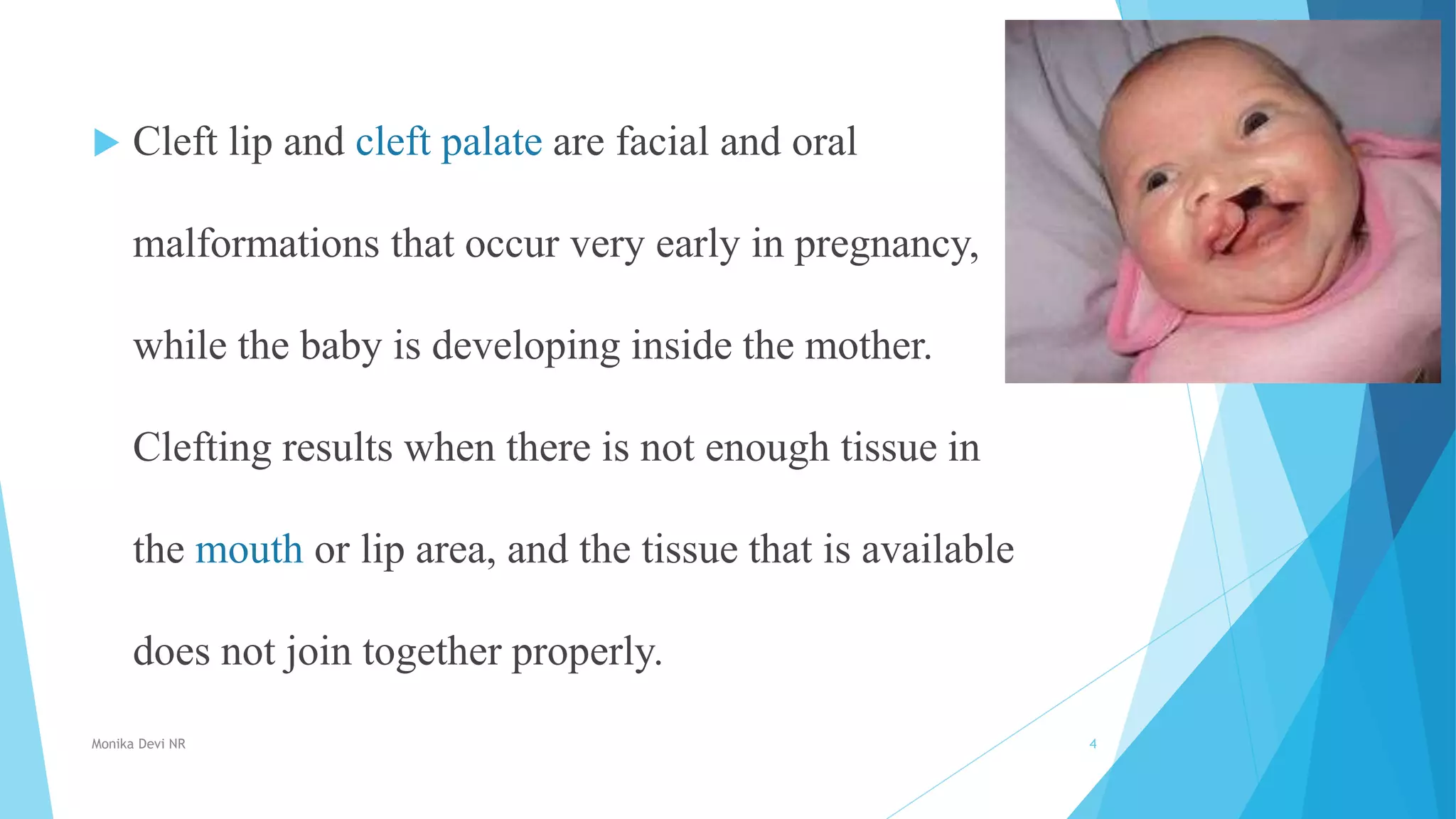 CLIFT LIP AND CLEFT PALATE | PPTX | Ear, Nose and Throat Conditions | Diseases and Conditions