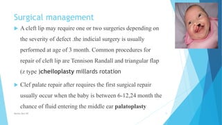 CLIFT LIP AND CLEFT PALATE | PPTX | Ear, Nose and Throat Conditions | Diseases and Conditions