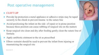 CLIFT LIP AND CLEFT PALATE | PPTX | Ear, Nose and Throat Conditions ...