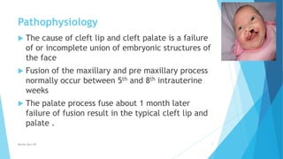 CLIFT LIP AND CLEFT PALATE | PPTX | Ear, Nose and Throat Conditions | Diseases and Conditions