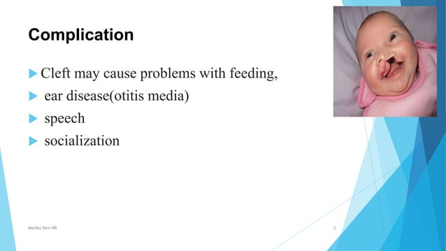 CLIFT LIP AND CLEFT PALATE | PPTX | Ear, Nose and Throat Conditions | Diseases and Conditions