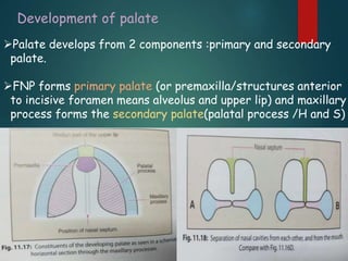 Cleft lip and cleft palate | PPT