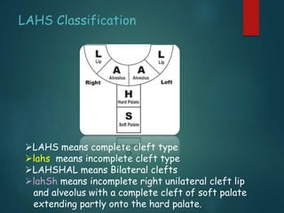 Cleft lip and cleft palate | PPT