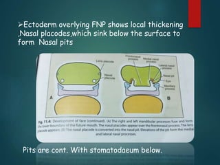 Cleft lip and cleft palate | PPTX