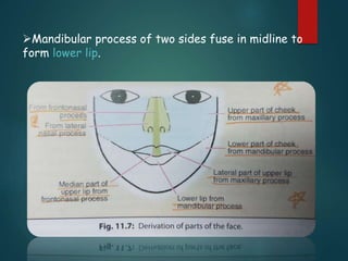 Cleft lip and cleft palate | PPT