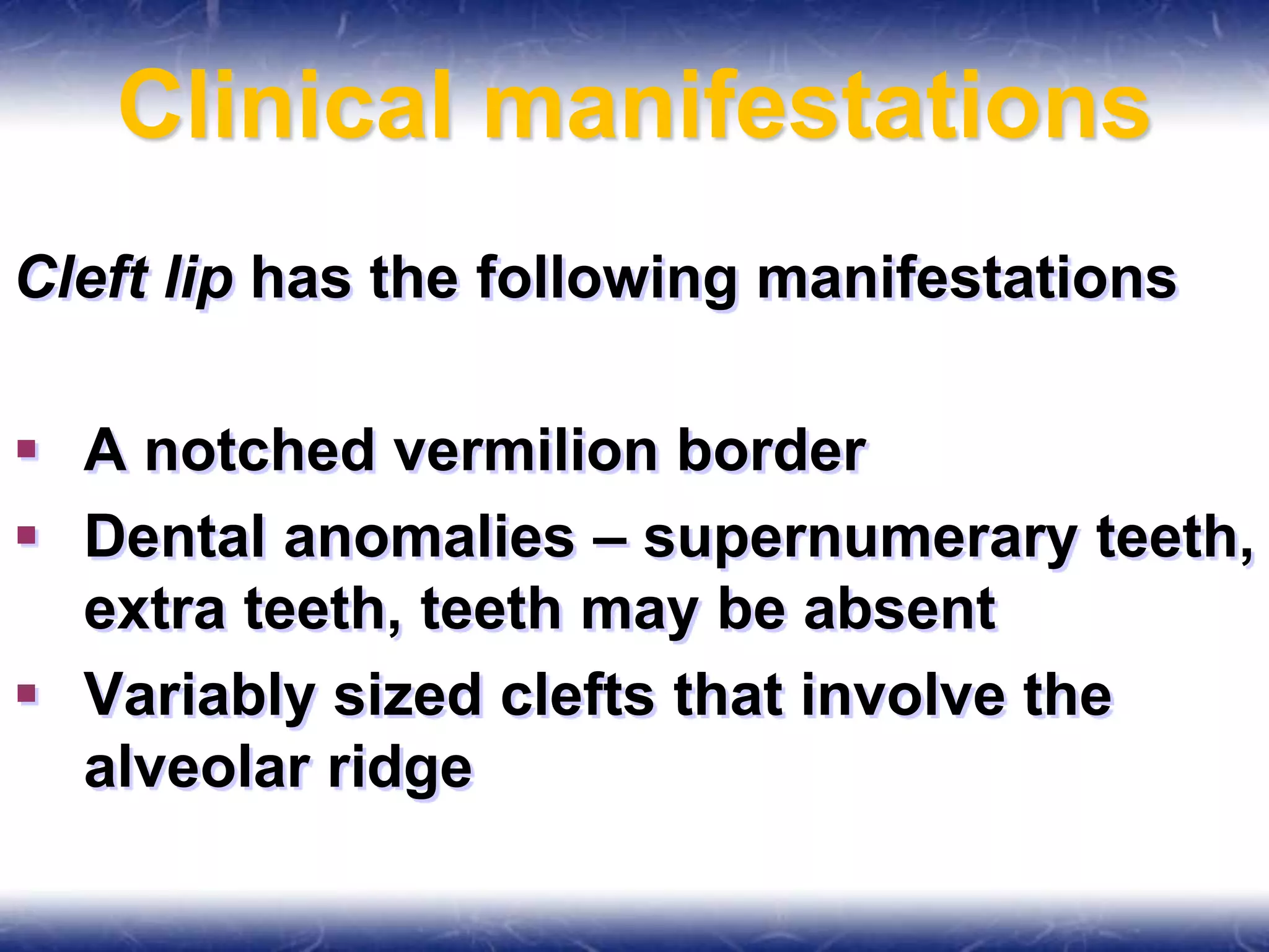 Cleft lip and cleft palate | PPTX