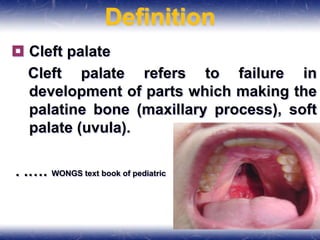 Cleft lip and cleft palate | PPTX