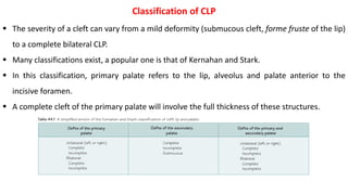 cleft lip and cleft palate.pdf