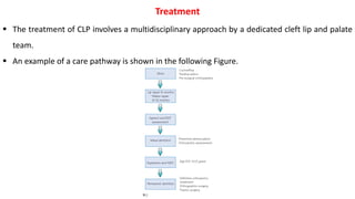 cleft lip and cleft palate.pdf